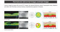 China Spectral Domain OCT Optical Coherence Tomography for ophthalmology department for sale