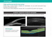 China Spectral Domain OCT Optical Coherence Tomography for ophthalmology department for sale