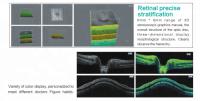 China Spectral Domain OCT Optical Coherence Tomography for ophthalmology department for sale