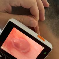 China Ear Otoscope Digital Video Otoscope Camera Otoscope Set Ear Endoscope for sale