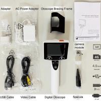 China Ear Otoscope Digital Video Otoscope Camera Otoscope Set Ear Endoscope for sale