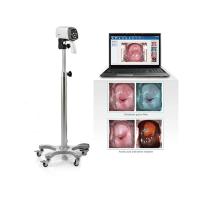 China EDAN C3A&C6A Video Colposcope for sale