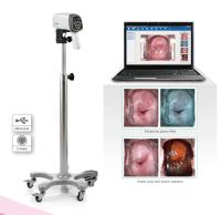 China EDAN C3A&C6A Video Colposcope for sale