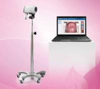 China EDAN C3A&C6A Video Colposcope for sale