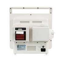 China Aurora SP built-in mini thermal transfer printer module for patient monitor for sale
