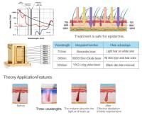 China diode hair removal 3 Wavelength Diode Laser Hair Removal System 755nm 808nm 1064nm Beauty Care Device for sale