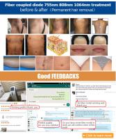 China diode hair removal 3 Wavelength Diode Laser Hair Removal System 755nm 808nm 1064nm Beauty Care Device for sale