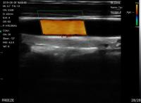 China Wifi Ultrasound Probe Convex Linear Phasedarray 80/128/192 Color Doppler Wireless for sale