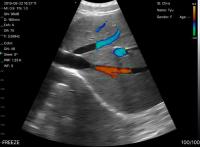 China Wifi Ultrasound Probe Convex Linear Phasedarray 80/128/192 Color Doppler Wireless for sale