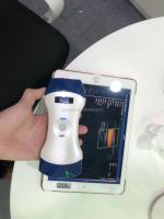 China Wifi Ultrasound Probe Convex Linear Phasedarray 80/128/192 Color Doppler Wireless for sale