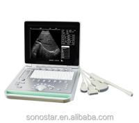 China Ultrasound Machine For Veterinary / Human Sonostar Portable Laptop Ultrasound Machine for sale