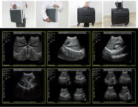 China Ultrasound Machine For Veterinary / Human Sonostar Portable Laptop Ultrasound Machine for sale