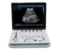 China PC based 3D Ultrasound Machine SS-9 Laptop Ultrasound scanner for sale