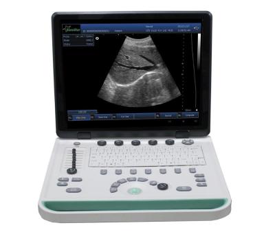 China PC based 3D Ultrasound Machine SS-9 Laptop Ultrasound scanner for sale