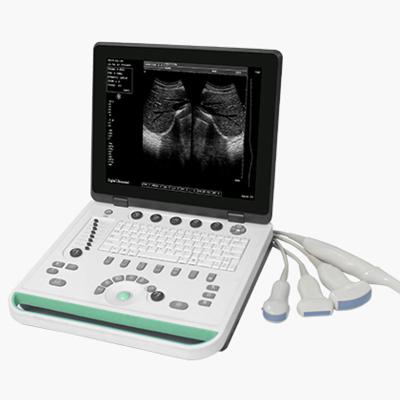 China 15 inch Cheap Hotsell SS-7 Vet Ultrasound Portable Machine Equipment High Image for sale
