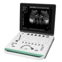 China 15 inch Cheap Hotsell SS-7 Vet Ultrasound Portable Machine Equipment High Image for sale