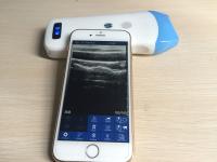 China New products Phone / Android wireless USB probe mobile phone ultrasound for clinic for sale