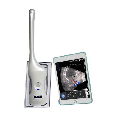 China Convex Linear  Phased Transvaginal Wireless 3 in 1 Portable Ultrasound Scanner Probe for sale