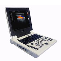China Best Cheap Price Medical Ultrasound Diagnostic System Laptop Portable Color Doppler Ultrasound Machine for Hospital for sale