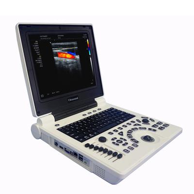 China Best Cheap Price Medical Ultrasound Diagnostic System Laptop Portable Color Doppler Ultrasound Machine for Hospital for sale