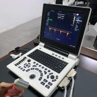 China Best Cheap Price Medical Ultrasound Diagnostic System Laptop Portable Color Doppler Ultrasound Machine for Hospital for sale