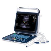 China Color Doppler Portable Ultrasound Machine Medical USG PW CW DICOM Cardiac Probe Cardiology for Hospital Clinic for sale