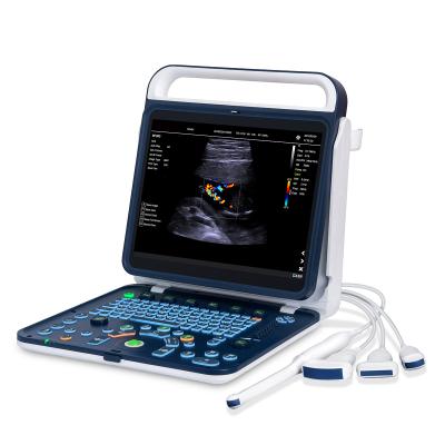China Color Doppler Portable Ultrasound Machine Medical USG PW CW DICOM Cardiac Probe Cardiology for Hospital Clinic for sale