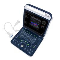 China Color Doppler Portable Ultrasound Machine Medical USG PW CW DICOM Cardiac Probe Cardiology for Hospital Clinic for sale