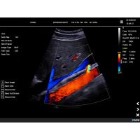 China Color Doppler Portable Ultrasound Machine Medical USG PW CW DICOM Cardiac Probe Cardiology for Hospital Clinic for sale
