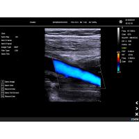 China Color Doppler Portable Ultrasound Machine Medical USG PW CW DICOM Cardiac Probe Cardiology for Hospital Clinic for sale