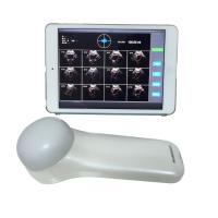 China Portable 4D Wireless Bladder Scanner WIFI Ultrasound Probe for Evaluation of Residual Quality After Urination for sale