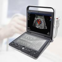 China Sonoscape S9 Pregnant Baby Medical Diagnosis 4D Color Doppler Sonography Machine Portable Ultrasound for sale