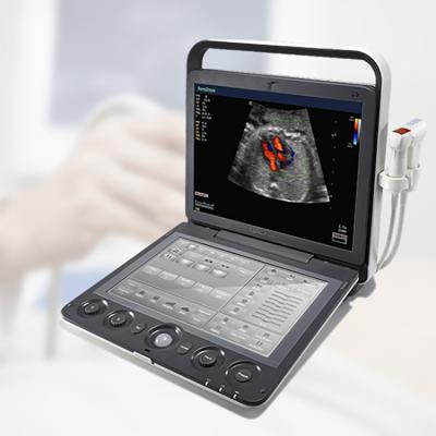 China Sonoscape S9 Pregnant Baby Medical Diagnosis 4D Color Doppler Sonography Machine Portable Ultrasound for sale