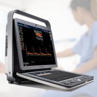 China Sonoscape S9 Pregnant Baby Medical Diagnosis 4D Color Doppler Sonography Machine Portable Ultrasound for sale