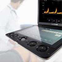 China Sonoscape S9 Pregnant Baby Medical Diagnosis 4D Color Doppler Sonography Machine Portable Ultrasound for sale