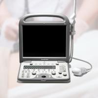 China Sonoscape S8 B/ 2B/ 4B/ M/CW Echocardiography Ecograph 4D Laptop Notebook Portable Color Doppler for sale