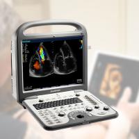 China Sonoscape S8 B/ 2B/ 4B/ M/CW Echocardiography Ecograph 4D Laptop Notebook Portable Color Doppler for sale