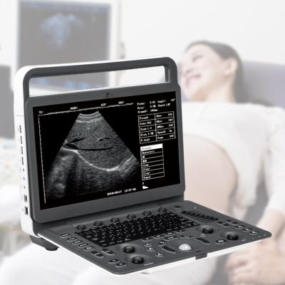 China Sonoscape E2 Ecografo Cardiac Vascular Diagnosis B/ 2B/ 4B/ M/ Color Doppler Ultrasound Machine Requipo De Ultrasonido for sale