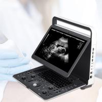 China Sonoscape E2 Ecografo Cardiac Vascular Diagnosis B/ 2B/ 4B/ M/ Color Doppler Ultrasound Machine Requipo De Ultrasonido for sale