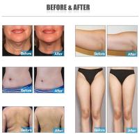 China Cryo+Laser+40k Cavitation for Body Face 360 Surrounding Cooling Technology Slimming Machine for Beauty Clinic Salon for sale