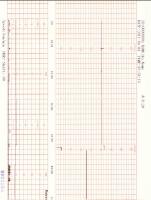 China ctg machine maternal and fetal doppler monitor for TOCO,FHR,FM DM002 for sale