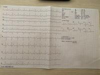 China 3 6 12 Channel ECG Machine Digital EKG Cardiograph for Hospital Cheap Price for sale