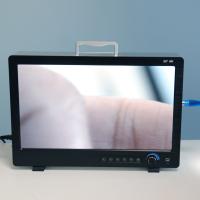 China Portable Full HD Endoscope Camera For ENT Laparoscopy Hysteroscopy Cystoscopy Surgery Equipment for sale
