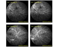 China Confocal Retina Ophthalmoscope One Integrated Lens Camera System Multi Imaging Modes for sale