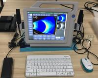 China Hand-held Ophthalmic A / B Scanner for Ophthalmology Price / Professional Ophthalmic Ultrasound for Sale for sale