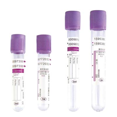 China Hospital Medical Purple Top Vacuum Collection Dna Sample K2 K3 Edta Capillary Blood Collection Tube for sale
