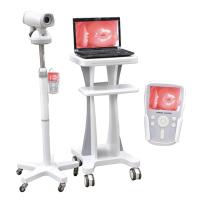 China Professional Video Colposcope Endoscope Gynaecology Colposcope CE03 for sale