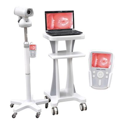 China Professional Video Colposcope Endoscope Gynaecology Colposcope CE03 for sale