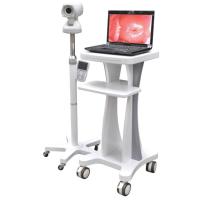 China Professional Video Colposcope Endoscope Gynaecology Colposcope CE03 for sale