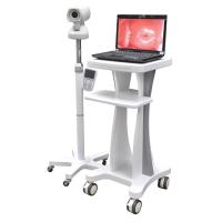 China Professional Video Colposcope Endoscope Gynaecology Colposcope CE03 for sale